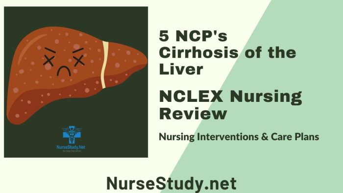 Liver Cirrhosis Nursing Diagnosis & Care Plan - NurseStudy.Net