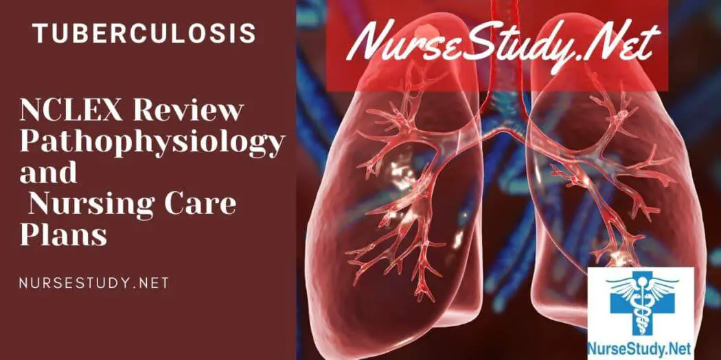 Tuberculosis TB Nursing Diagnosis Care Plan - NurseStudy.Net