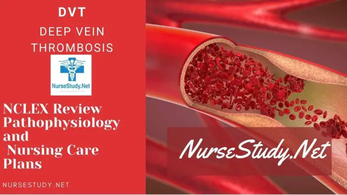 Deep Vein Thrombosis DVT Nursing Diagnosis & Care Plan - NurseStudy.Net