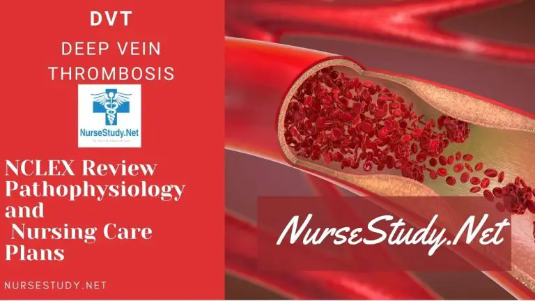 Deep Vein Thrombosis DVT Nursing Diagnosis & Care Plan - NurseStudy.Net