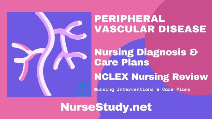 Peripheral Vascular Disease Nursing Diagnosis & Care Plan - NurseStudy.Net