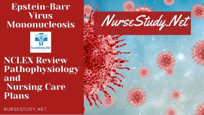Epstein-Barr Virus (EBV) Mononucleosis Nursing Diagnosis Interventions ...