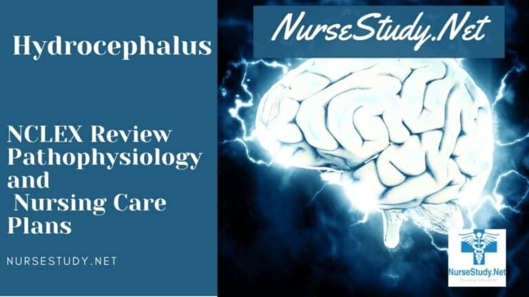 Hydrocephalus Nursing Diagnosis & Care Plan - NurseStudy.Net