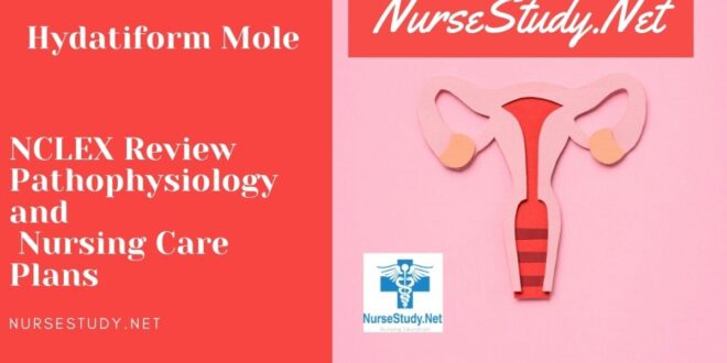 Hydatidiform Mole Nursing Diagnosis Interventions and Care Plans ...