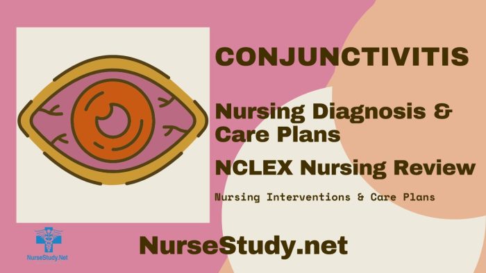 Conjunctivitis Nursing Diagnosis & Care Plan - NurseStudy.Net