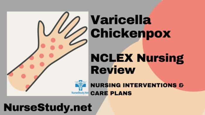 Varicella Nursing Diagnosis & Care Plan - NurseStudy.Net