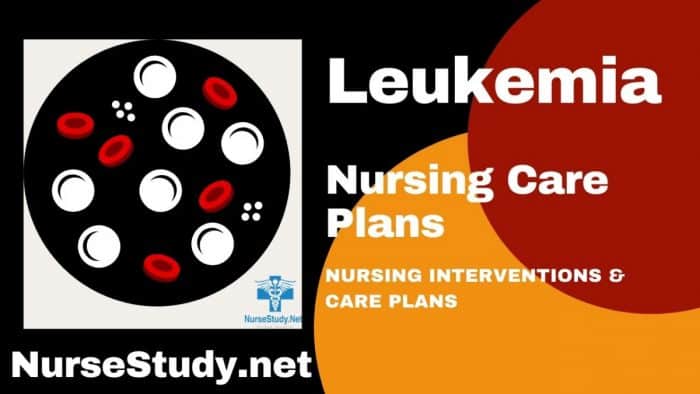 Leukemia Nursing Diagnosis & Care Plan - NurseStudy.Net
