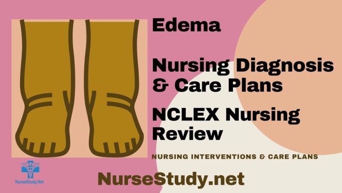 Edema Nursing Diagnosis and Care Plan - NurseStudy.Net