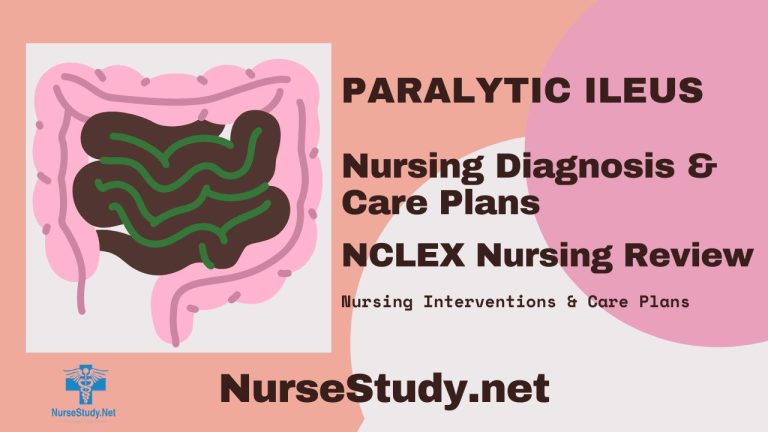 Paralytic Ileus Nursing Diagnosis & Care Plan - NurseStudy.Net