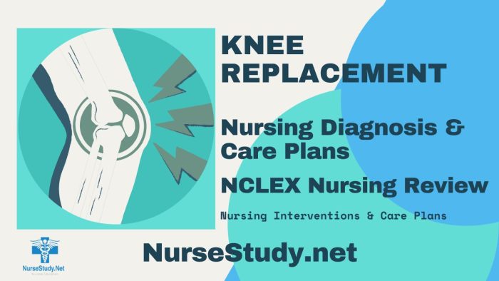 Knee Replacement Nursing Diagnosis & Care Plan - NurseStudy.Net